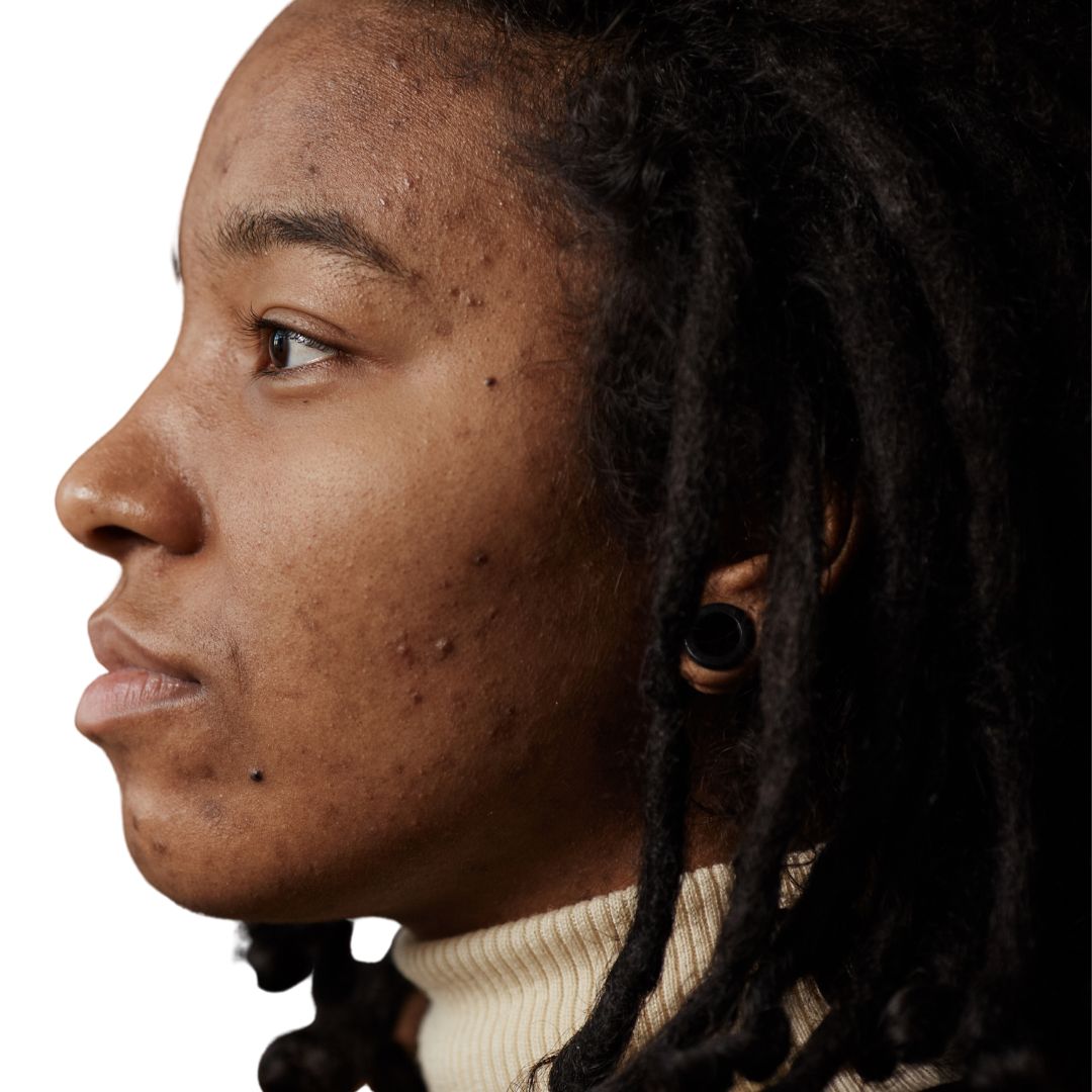 What Product Should I Use? Obvs skincare